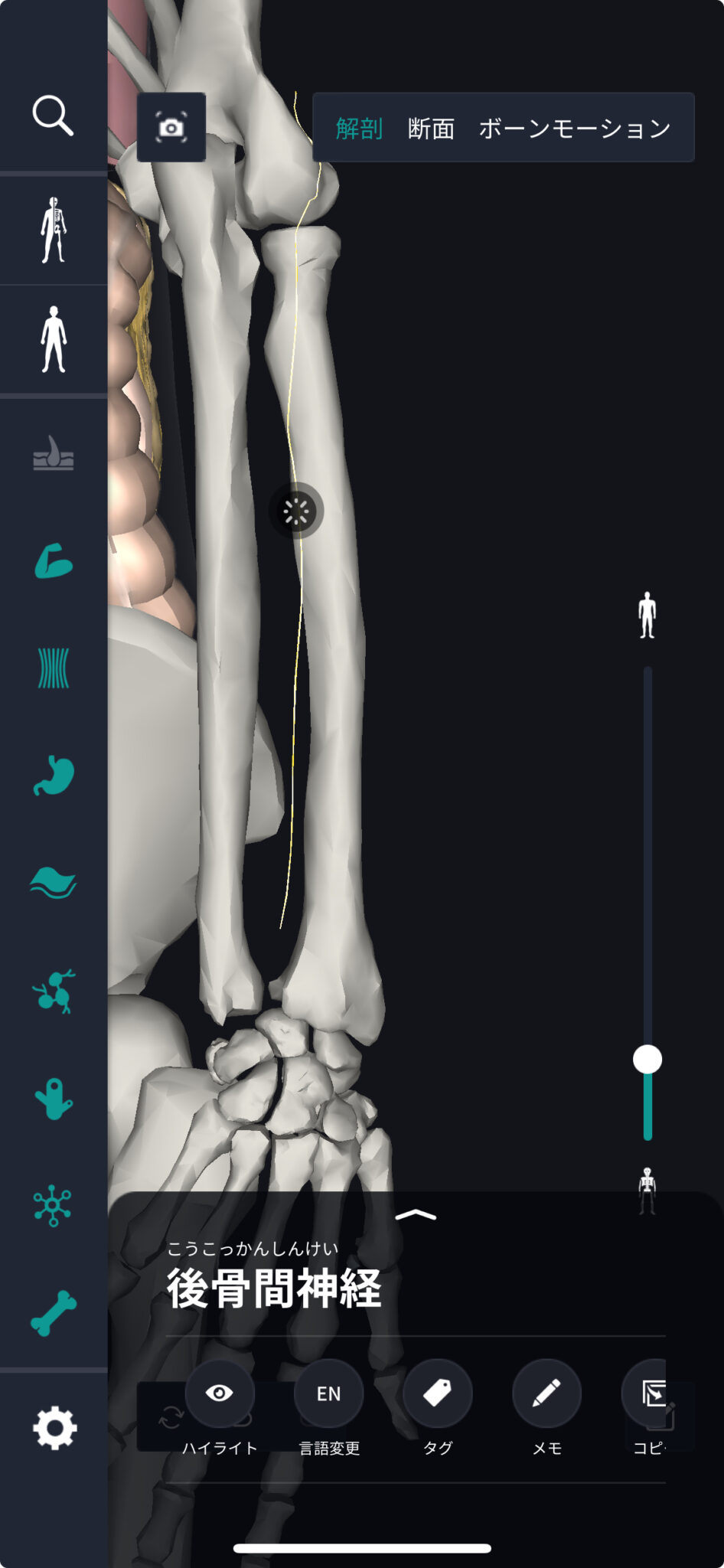 ¿Qué es el nervio interóseo posterior (nervio interóseo posterior ...