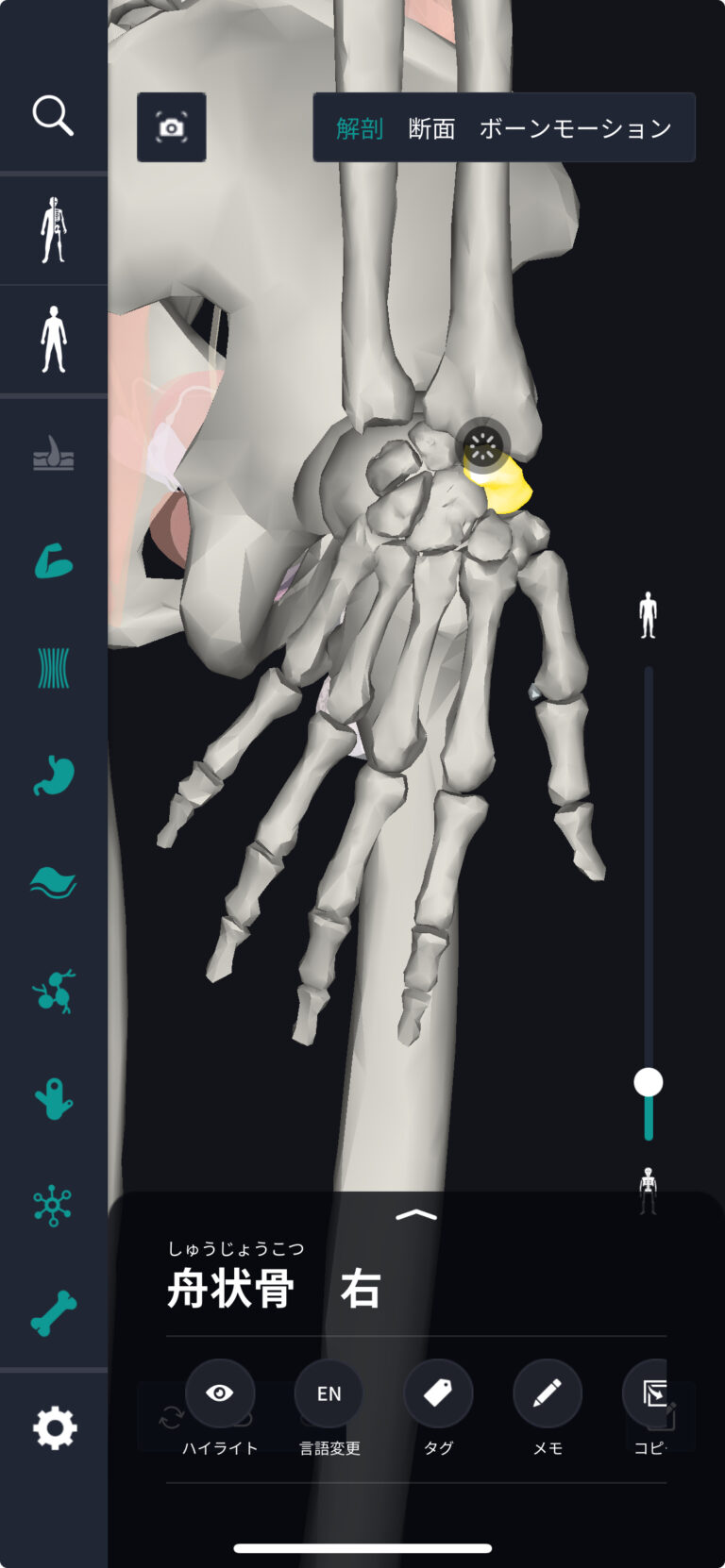 What is the scaphoid bone (scaphoid)? Explain locations, locations ...